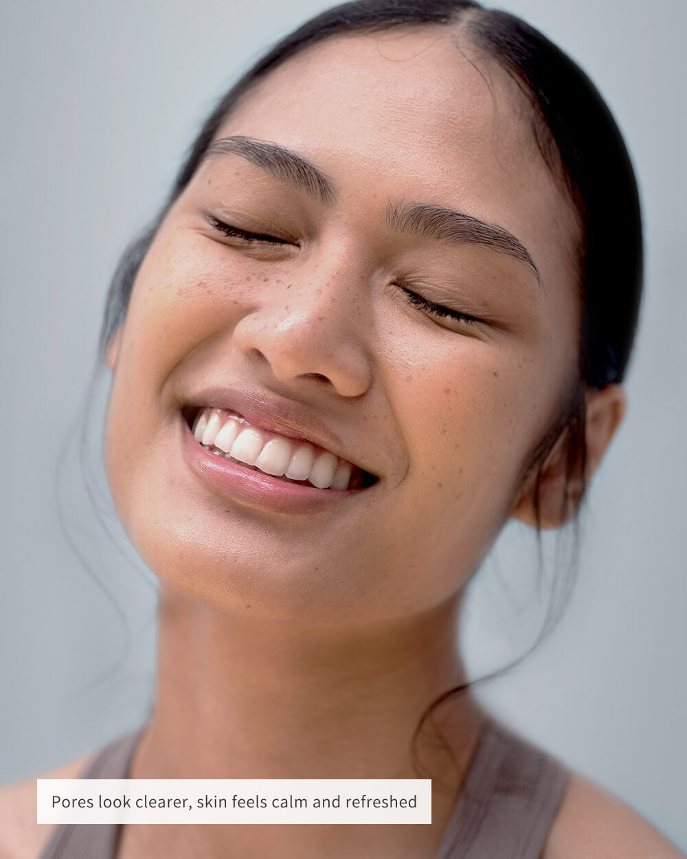 NOSE PATCHES – Vue Swiss