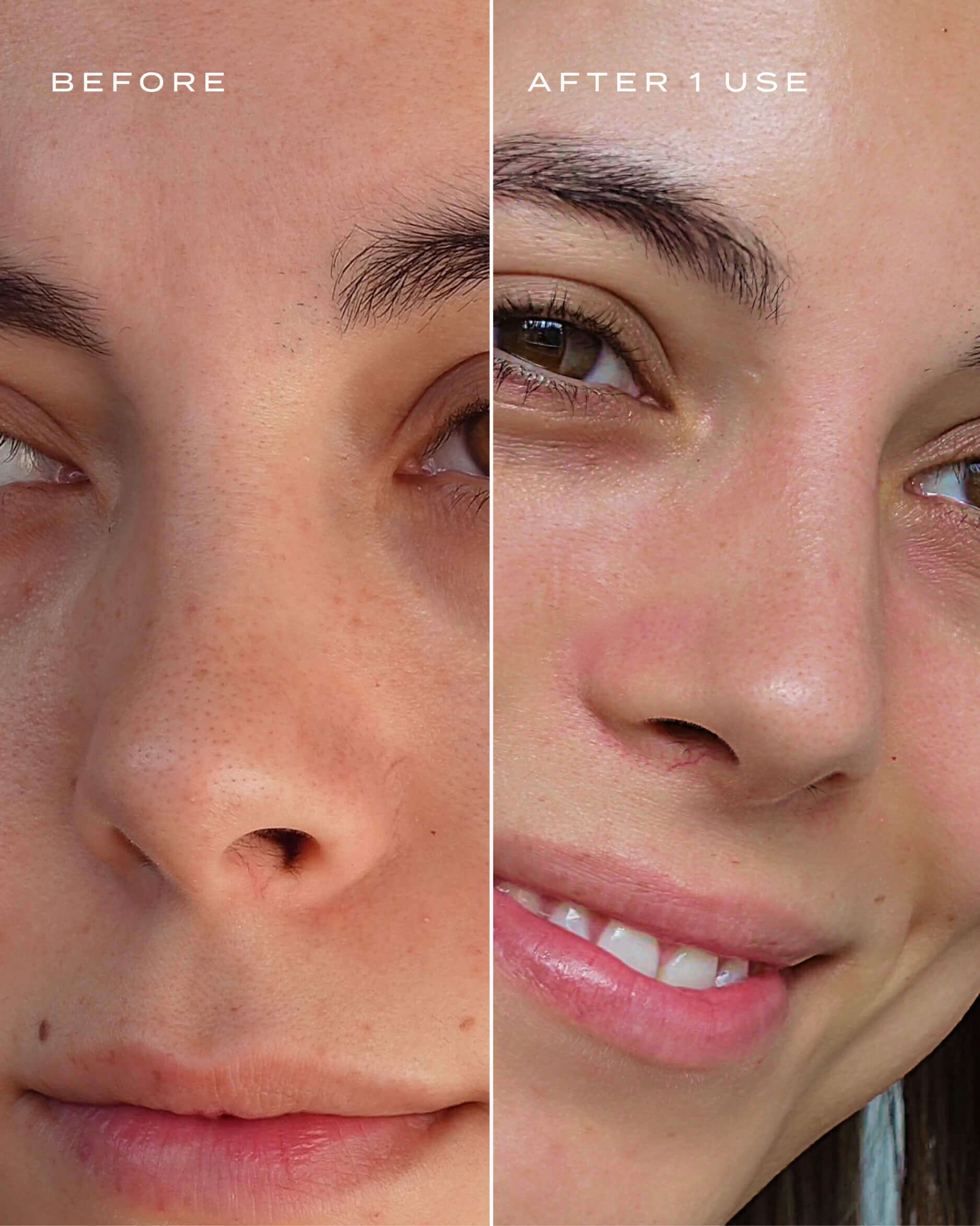 NOSE PATCHES – Vue Swiss